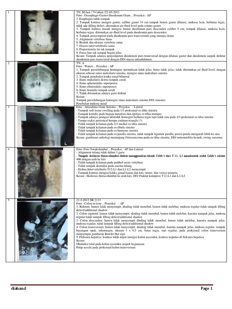 UJIAN - Radiologi Ujian Yuda-2 | PDF