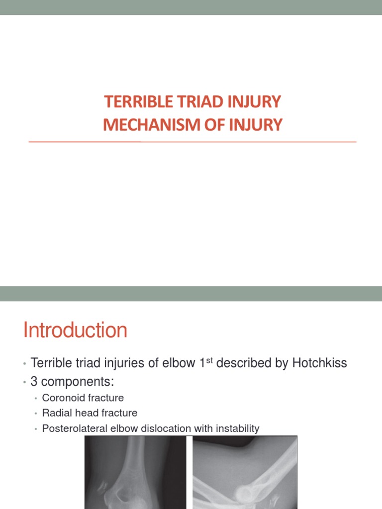 Terrible Triad Injury of The Elbow Joint | PDF | Elbow | Human Anatomy