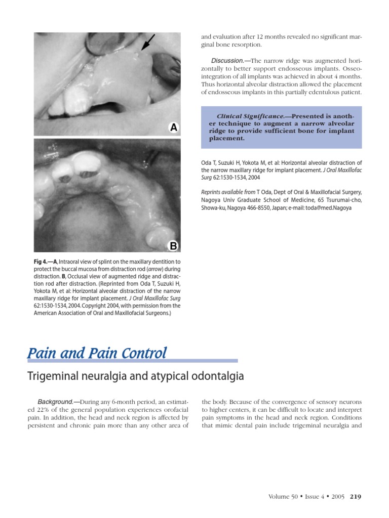 Trigeminal Neuralgia and Atypical Odontalgia 2005 | PDF | Pain ...