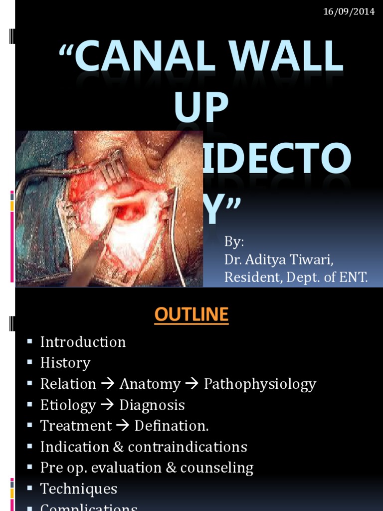 Canal Wall UP Mastoidecto MY: By: Dr. Aditya Tiwari, Resident, Dept. of ...