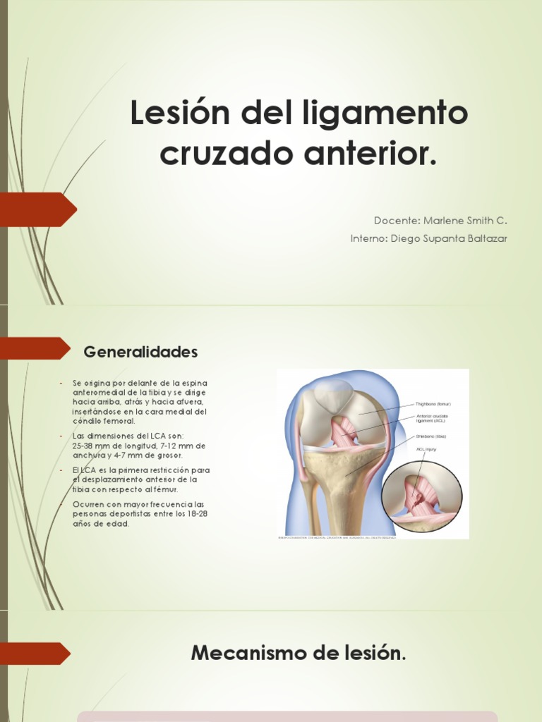 Lesión del ligamento cruzado anterior.: Docente: Marlene Smith C ...