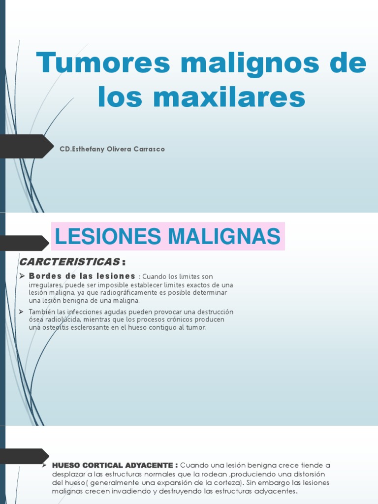 Tumores Malignos de Los Maxilares | PDF | Sarcoma | Hueso