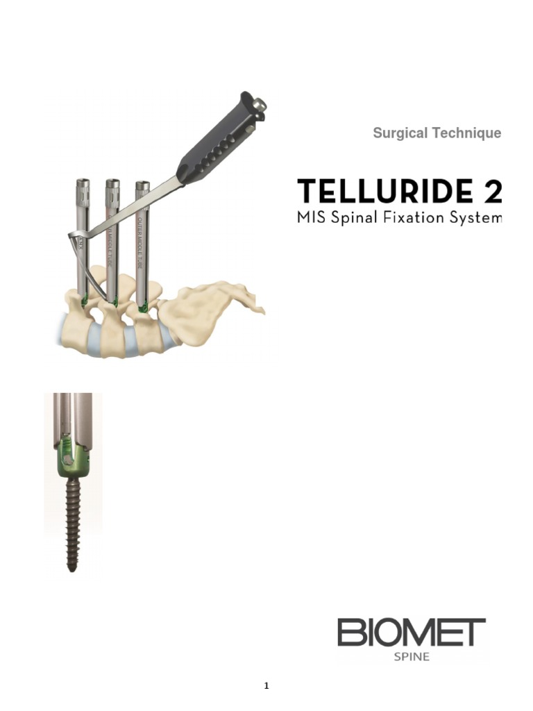 Telluride 2 Mis Spinal Fixation System Surgical Technique | PDF ...