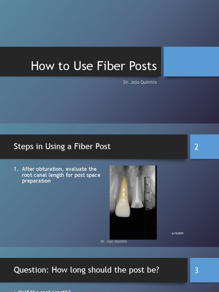 How To Use Fiber Posts | Download Free PDF | Dentistry | Dentistry Branches