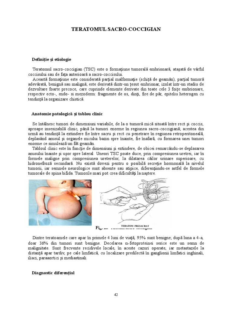 Cap.7. Teratom Sacrococcigian. Anomalii Tegumentare | PDF