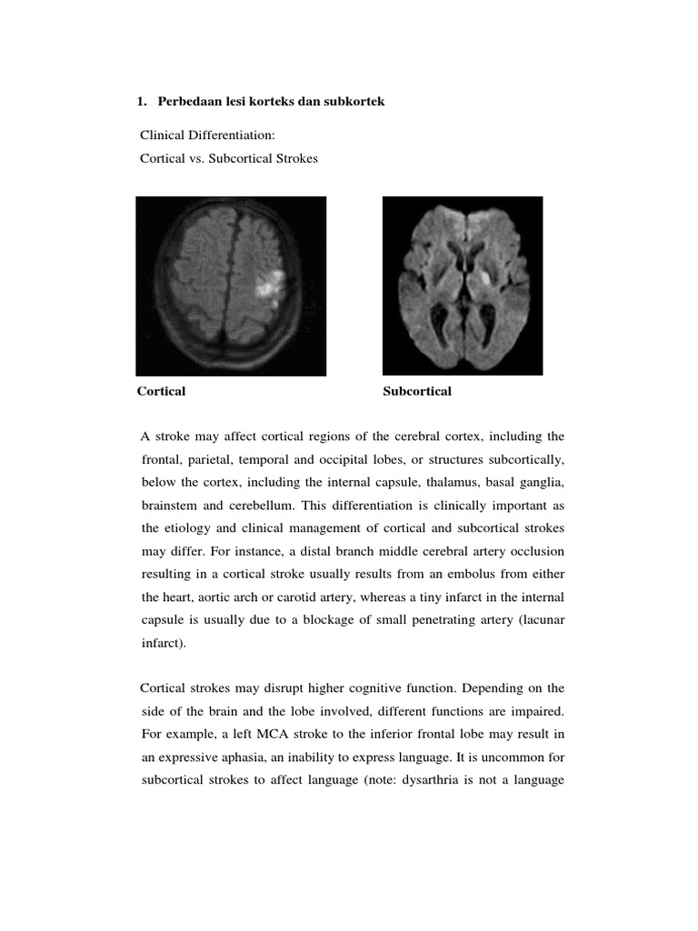 Clinical Differentiation of Cortical and Subcortical Strokes | PDF ...