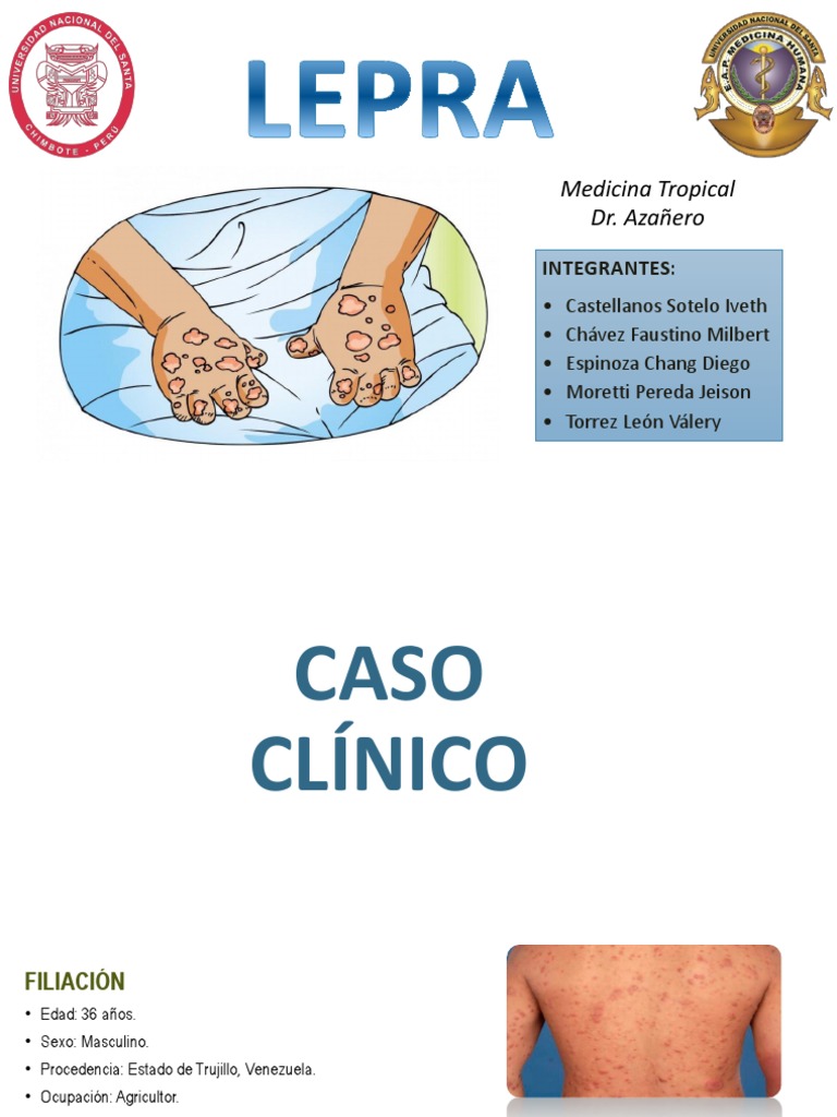 1 Lepra Exposición PDF | PDF | Lepra | Metabolismo