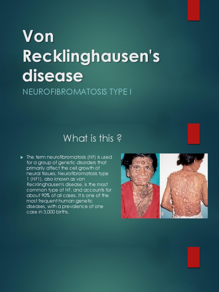 Von Recklinghausen's Disease | PDF | Genetic Disorder | Human Diseases ...