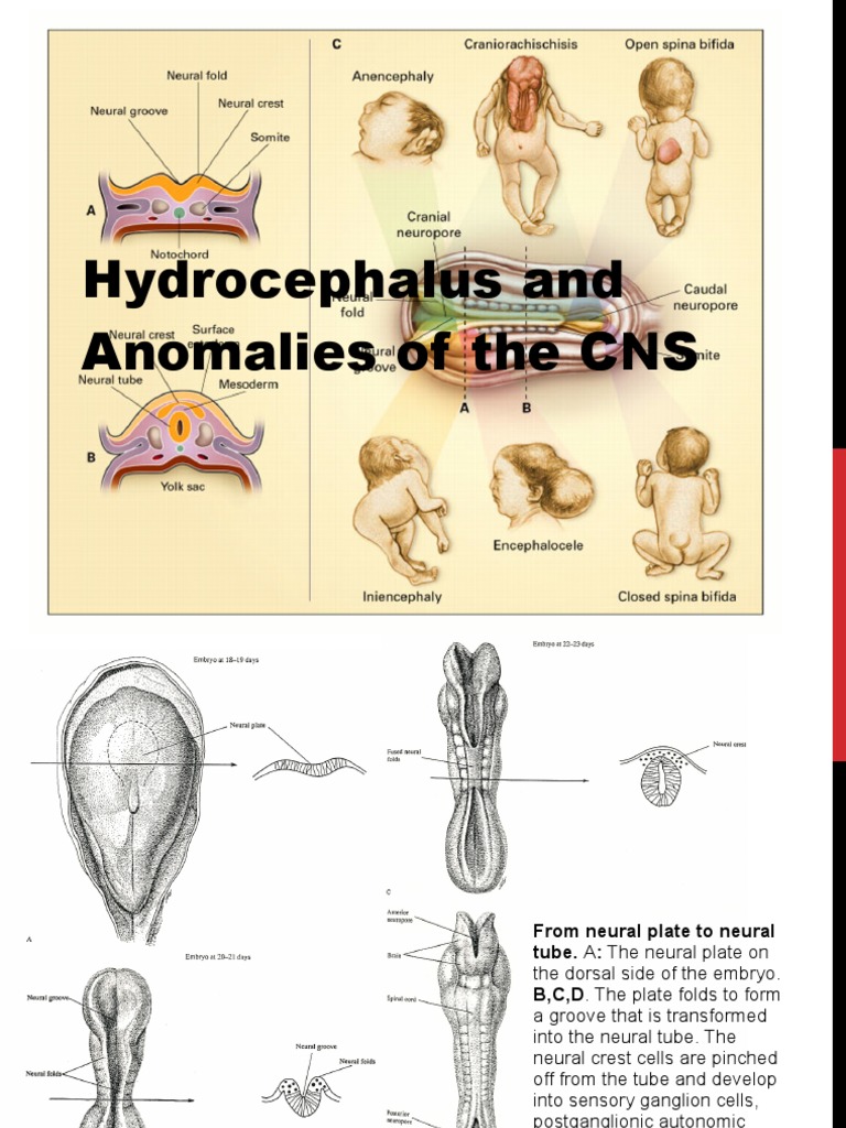 CNS Abnormalities | PDF | Cerebrospinal Fluid | Vertebral Column