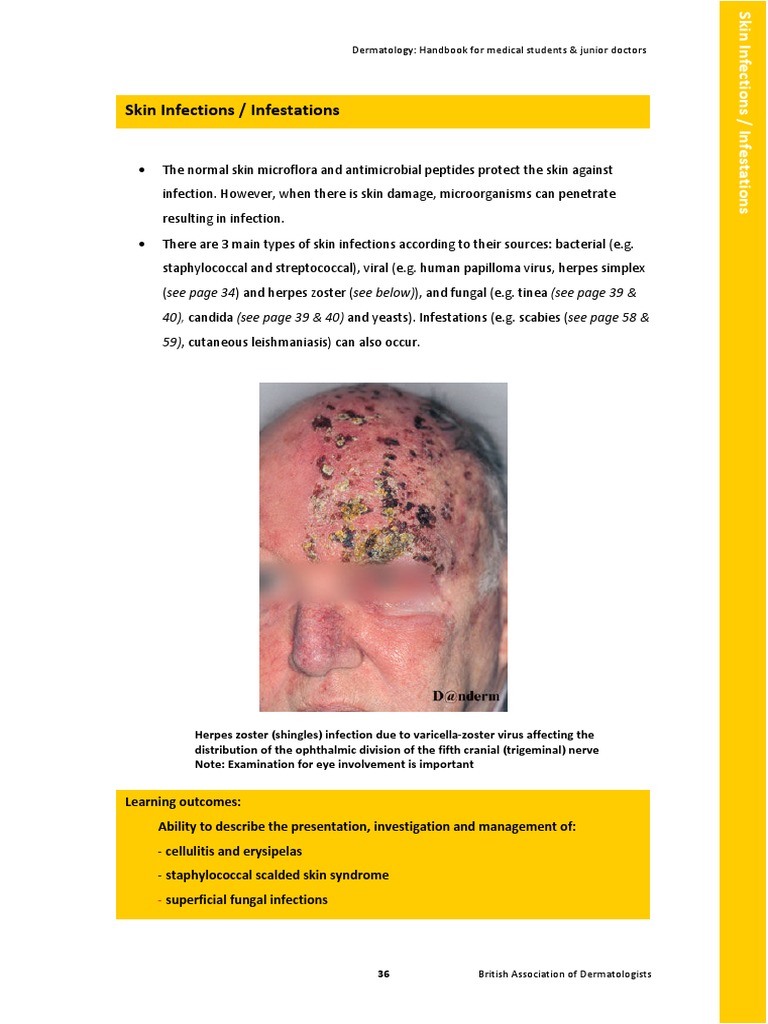 Skin Infections | PDF | Skin | Dermatology