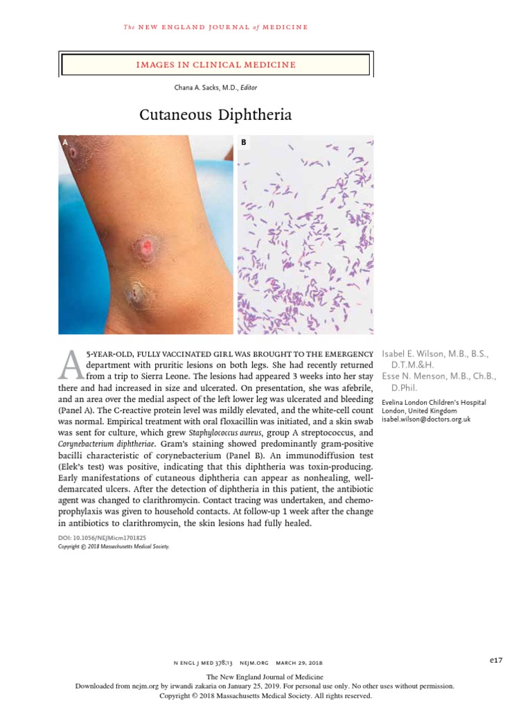 Cutaneous Diphtheria