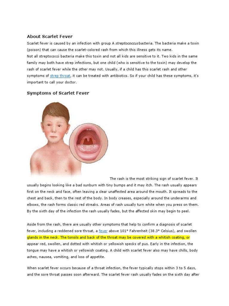 About Scarlet Fever: Strep Throat | PDF | Microbiology | Veterinary ...