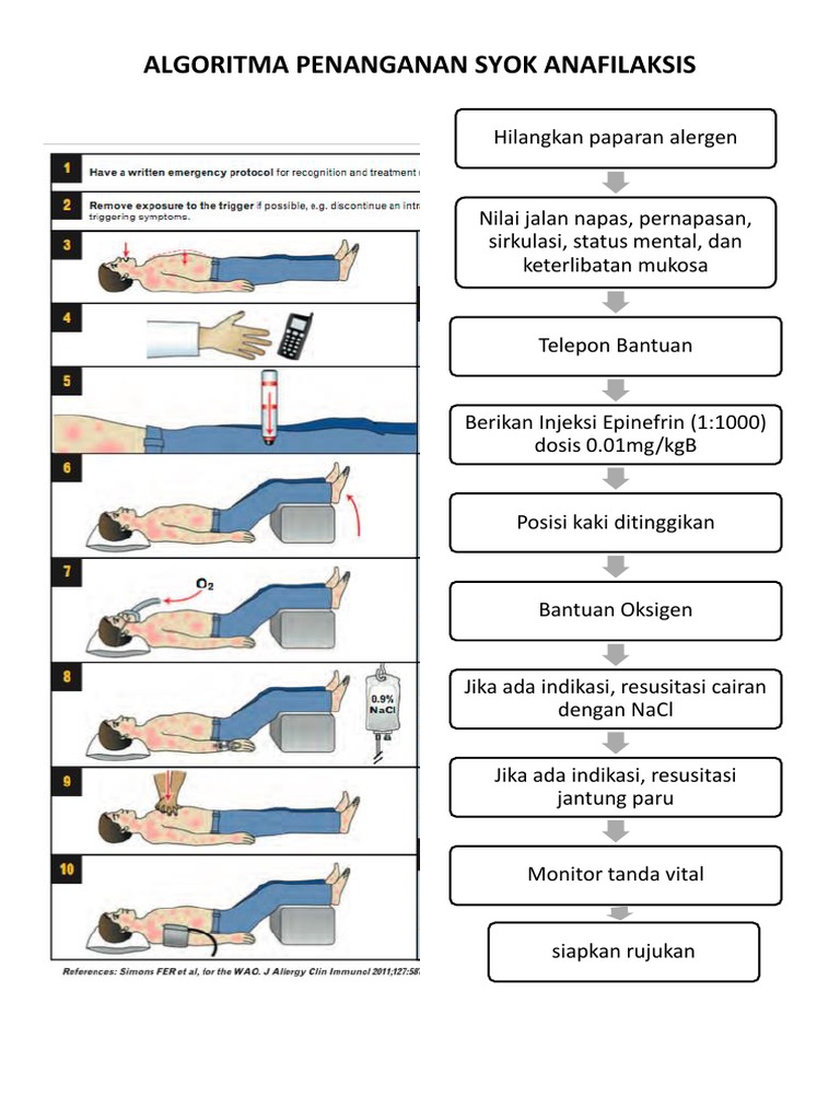 Algoritma Penanganan Syok Anafilaksis | PDF