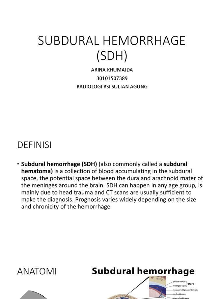 Subdural Hemorrhage Overview | PDF | Politics | Law
