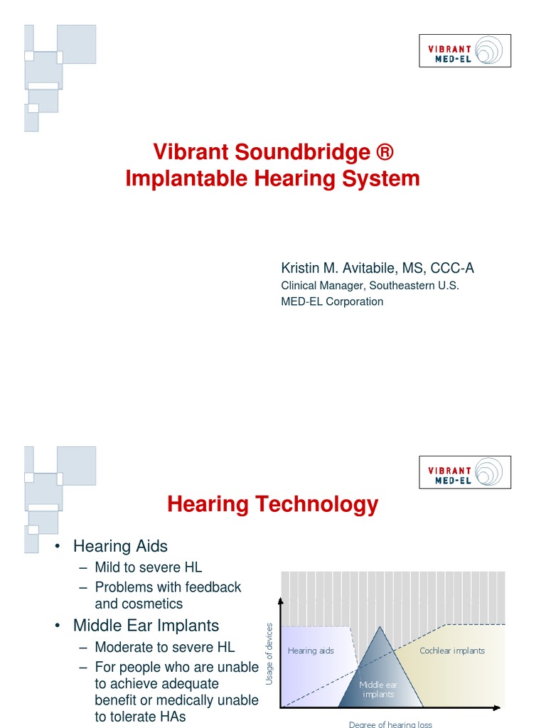 Vibrant Soundbridge ® Implantable Hearing System: Kristin M. Avitabile ...