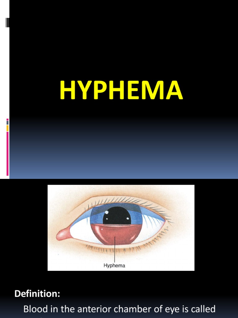 Hyphema | PDF | Bleeding | Medical Specialties