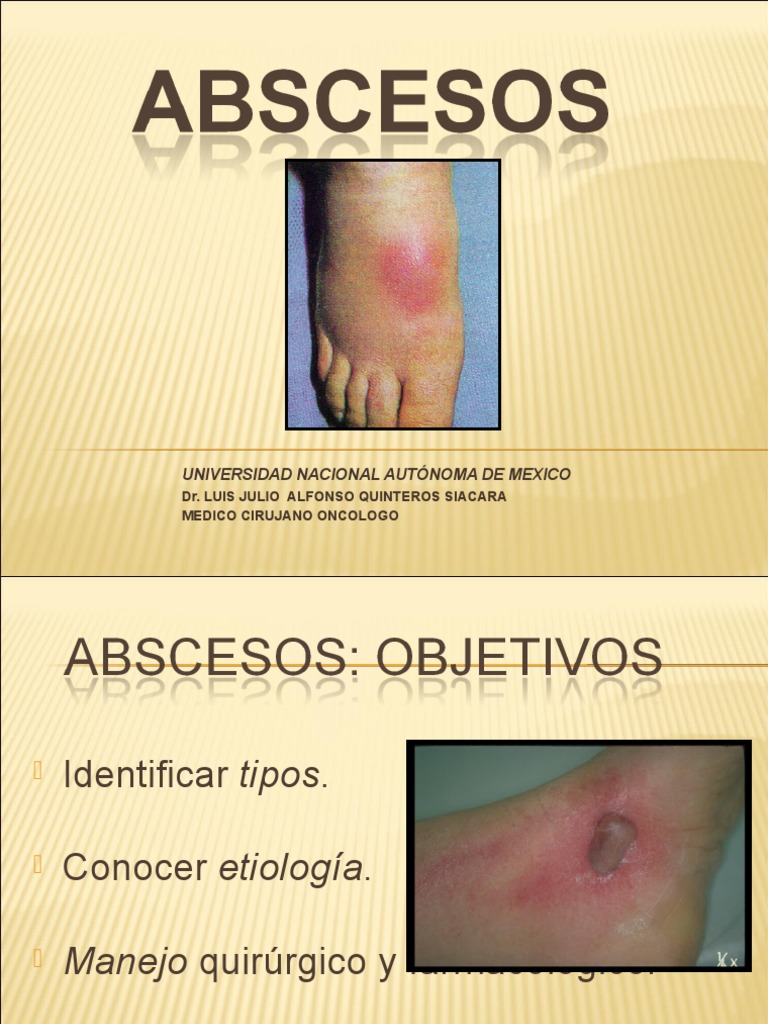 Abscesos y Drenajes DR Julio Quinteros | PDF | Inflamación | Medicina