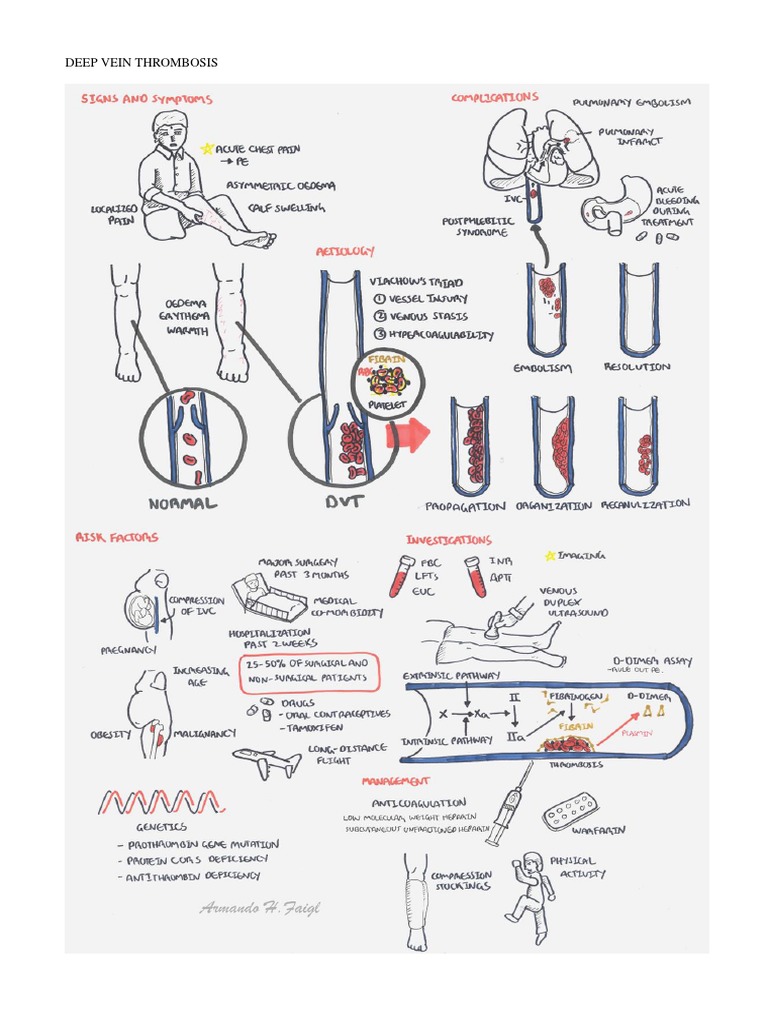 Deep Vein Thrombosis | PDF | Vein | Angiology