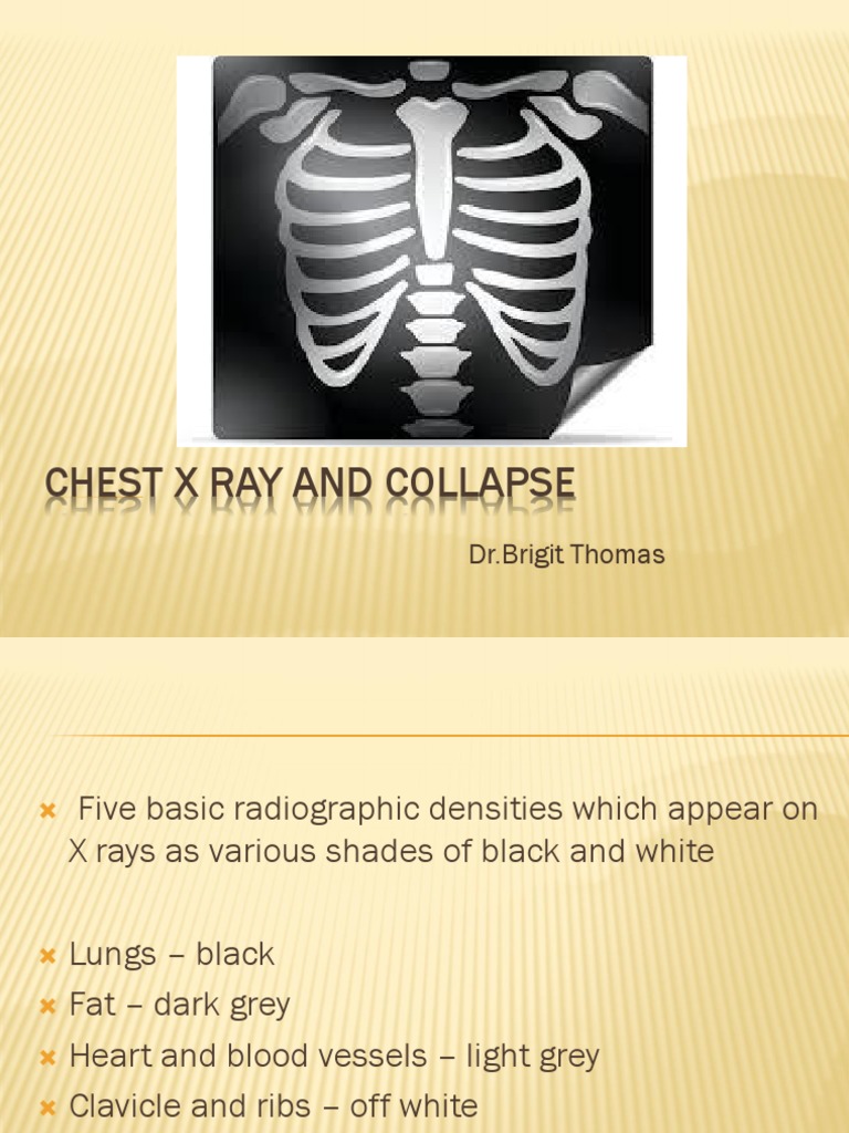 Chest X-Ray Interpretation & Collapse | PDF | Aorta | Lung