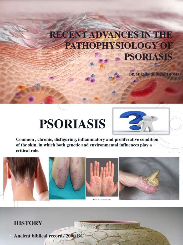 Recent Advances in The Pathophysiology of Psoriasis: Dr. Mikhin George ...