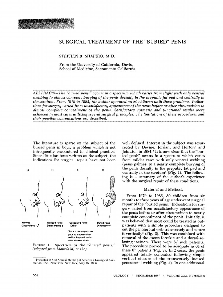 Surgical Treatment of The "Buried" Penis | PDF | Circumcision | Surgery