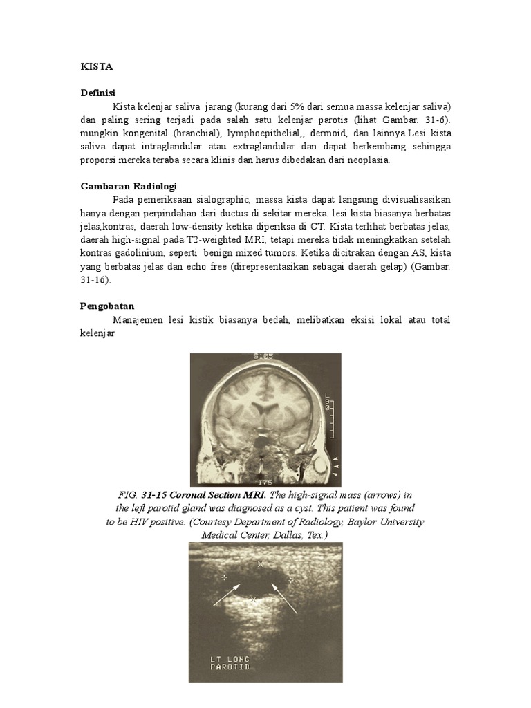 Radiografi Kista Rahang, Tumor | PDF