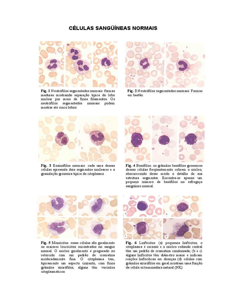 Leucograma Segmentados Livro Eletrônico Aula 00