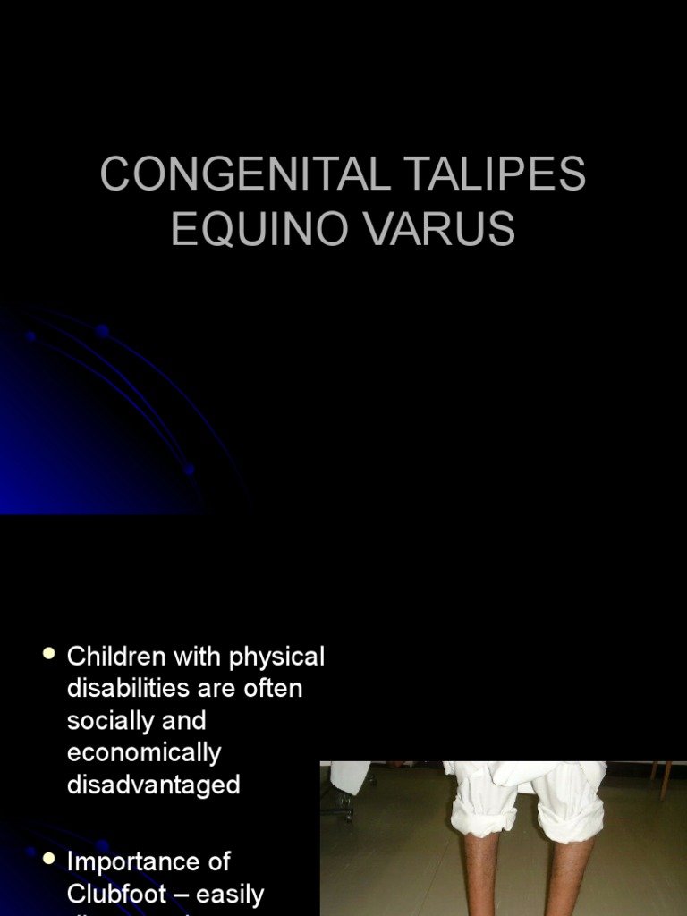 Congenital Talipes Equino Varus | PDF | Musculoskeletal System | Diseases And Disorders