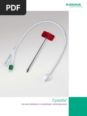Cystofix Suprapubic Catheter