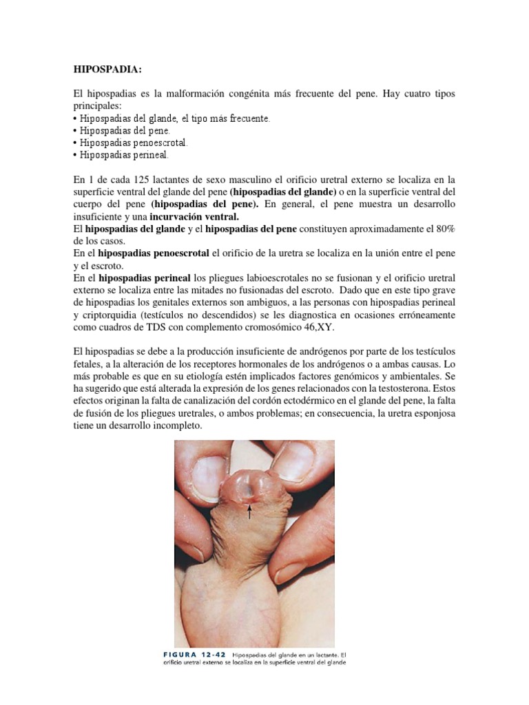 Hipospadia - Epispadia - Hernia Inguinal Congénita | PDF | Testículo ...