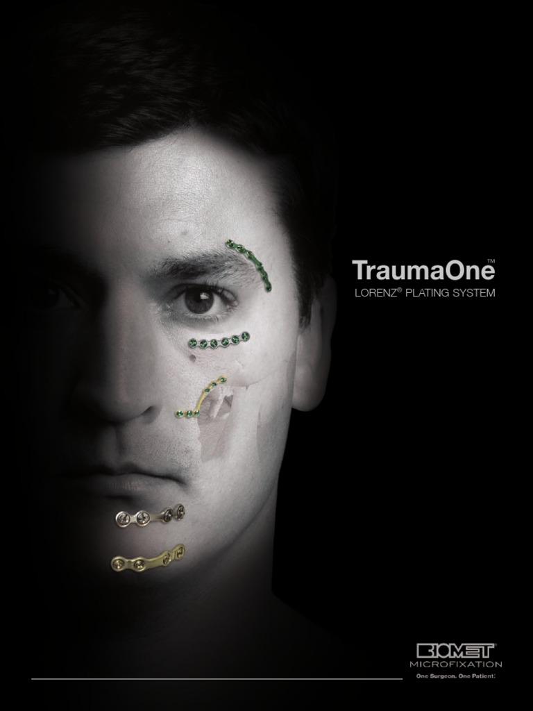 Traumaone Brochure 2 | PDF | Implant (Medicine) | Surgery