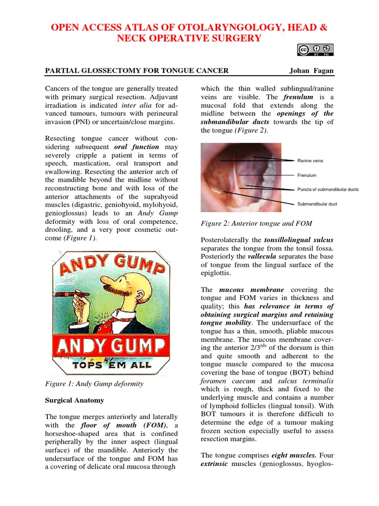 Tongue Resection | PDF | Tongue | Primate Anatomy