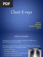 Chest X-Ray Template | PDF | Lung | Thorax
