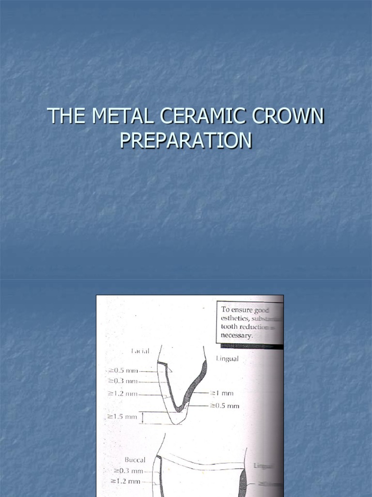 PFM Crown Preparation | PDF | Dentistry Branches | Medical Specialties