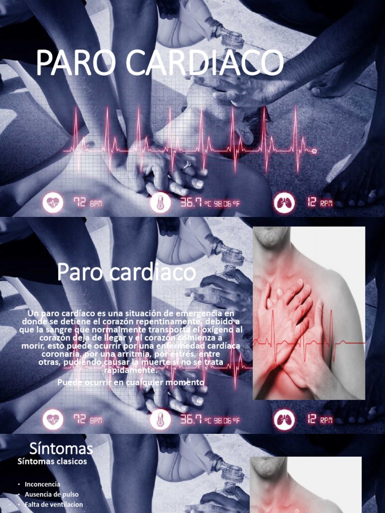 Paro Cardiaco | PDF | Reanimación cardiopulmonar | Paro cardíaco