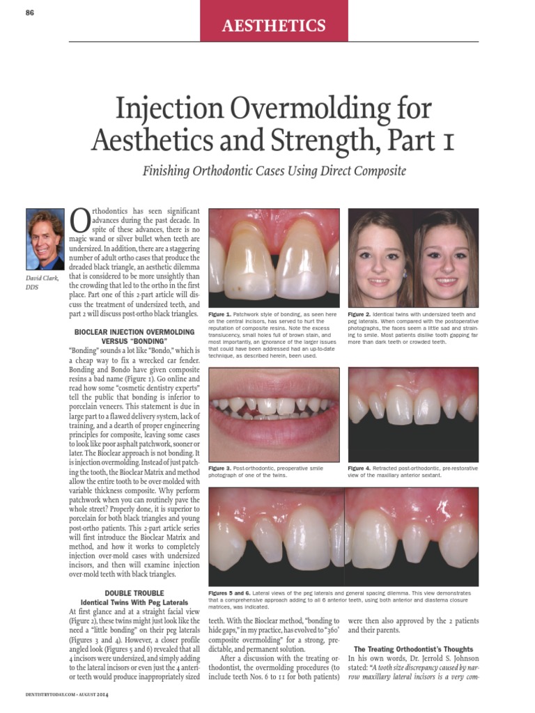 Injection Overmolding For Aesthetics and Strength Part 1 | PDF | Dental ...