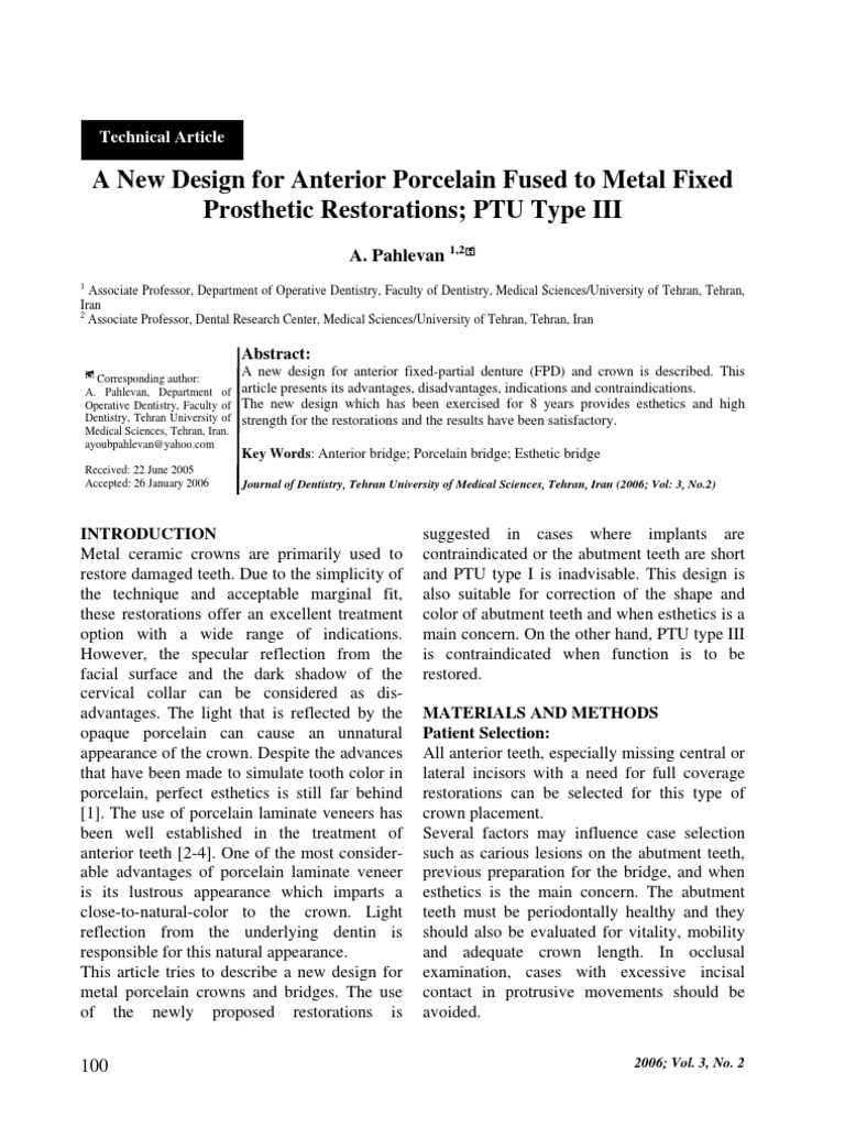 A New Design For Anterior Porcelain Fused To Metal Fixed Prosthetic ...