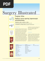 Prostate Fossa Contouring Guide | PDF | Prostate | Urinary Bladder