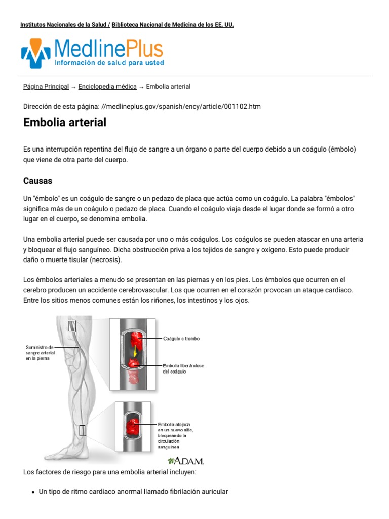 Embolia Arterial - MedlinePlus Enciclopedia Médica | PDF | Embolia ...