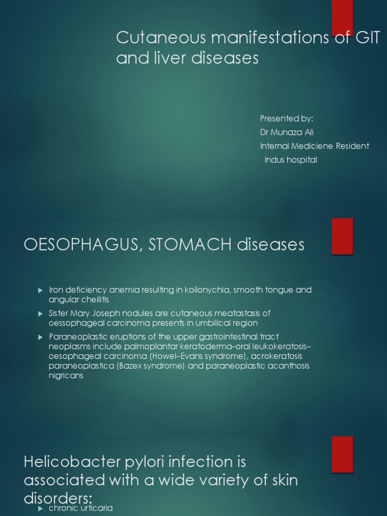 Skin Signs of Gastrointestinal Diseases | PDF | Cutaneous Conditions ...