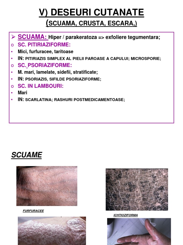 V) Deseuri Cutanate: Scuama, Crusta, Escara,) | PDF
