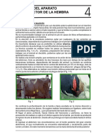 Pasos Quirúrgicos para La Cesárea Tipo Kerr | PDF | Abdomen | Seccion ...