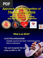 10 Common EKG Heart Rhythms PDF | PDF | Science & Mathematics | Lifestyle