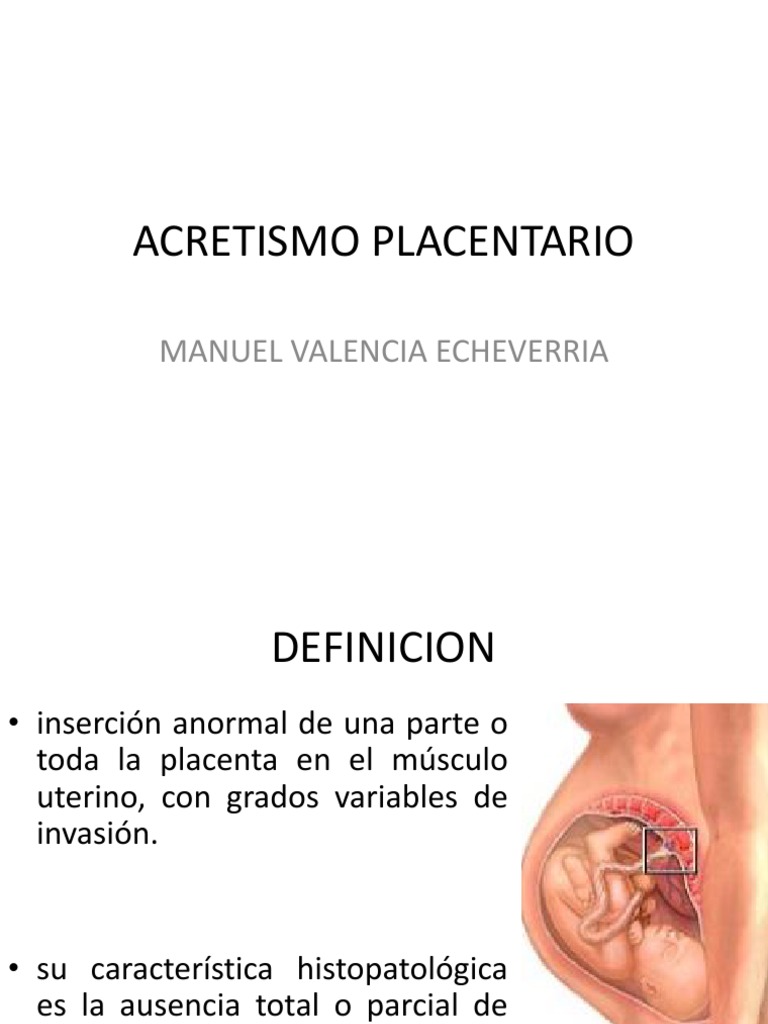 ACRETISMO PLACENTARIO.pptx | Embarazo Mamífero | Rtt