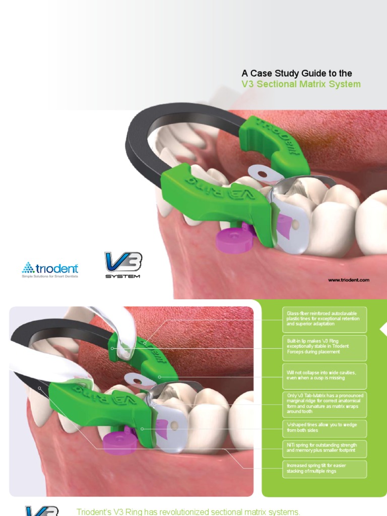 A Comprehensive Guide to the Effective Use of Triodent's V3 Sectional ...