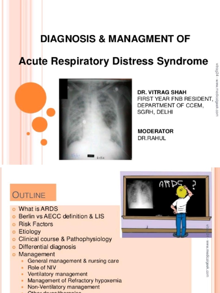 ARDS ppt | Pulmonology | Respiratory System