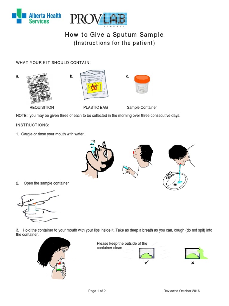 WF Provlab How To Give A Sputum Sample | PDF