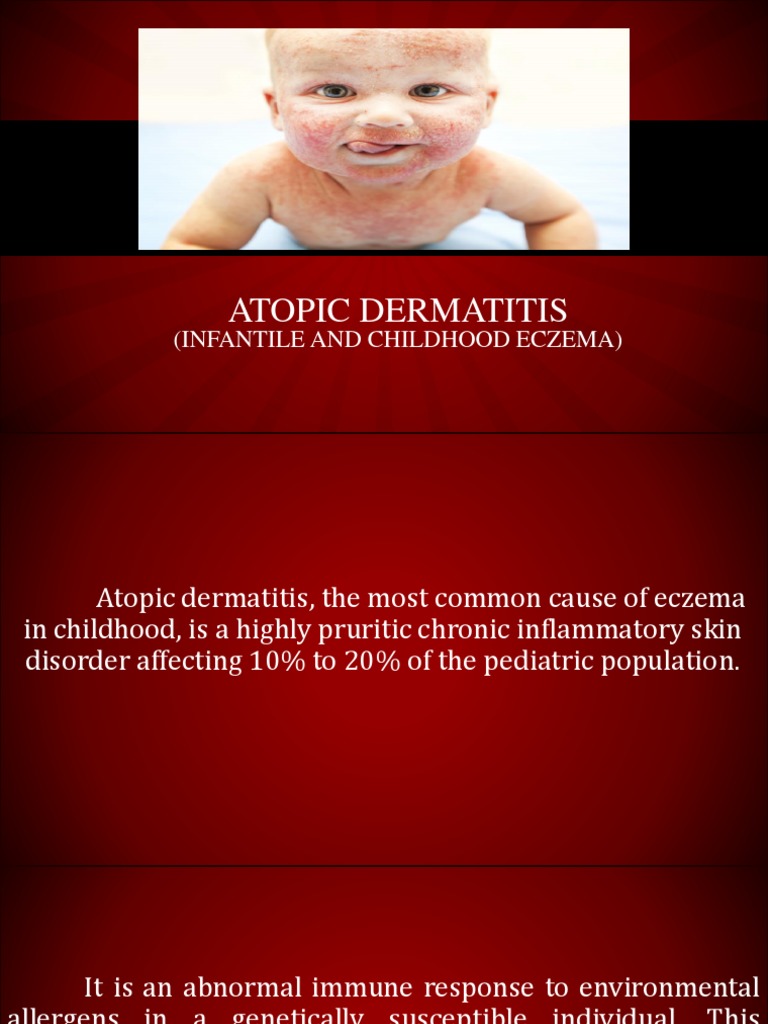 Atopic Dermatitis: (Infantile and Childhood Eczema) | PDF | Dermatitis ...