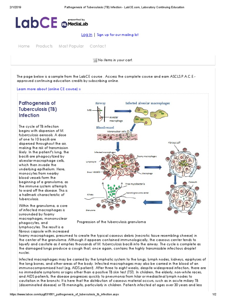 Pathogenesis of Tuberculosis (TB) Infection - LabCE - Com, Laboratory ...