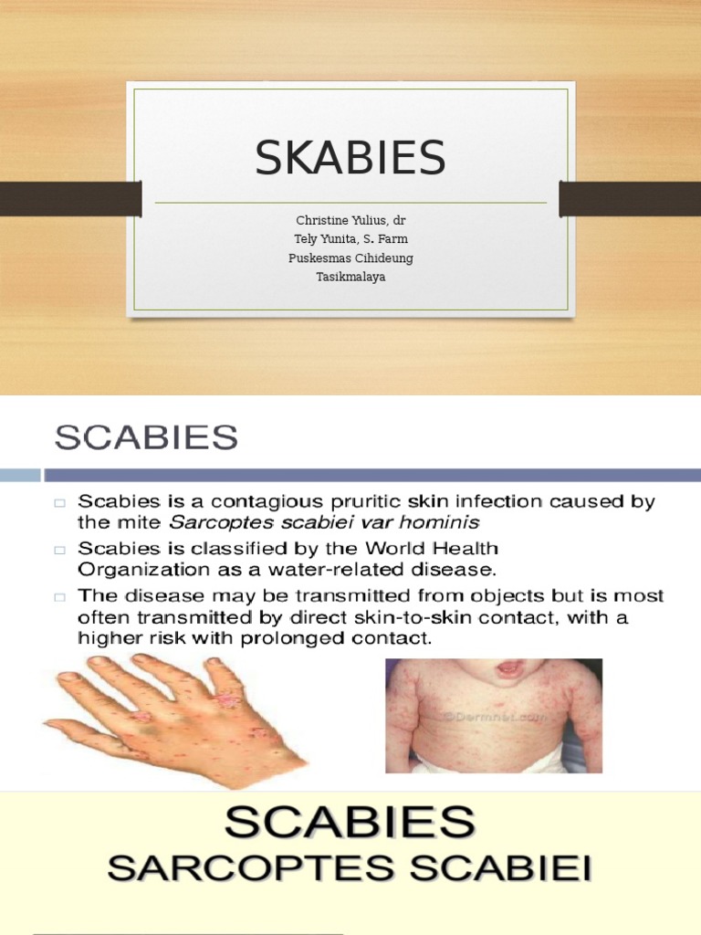 Scabies | PDF